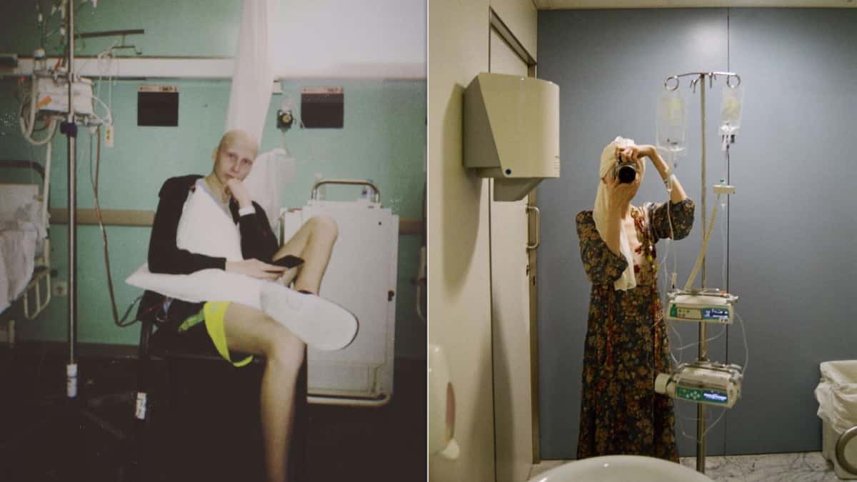 Vivir el cáncer y contarlo a través de TikTok: el caso de Charlie no es ...