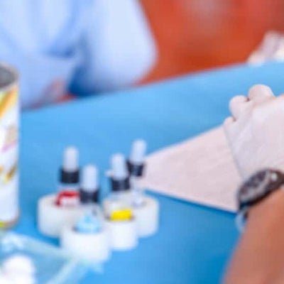 Laboratorio en EEUU identifica nueva cepa poco común del VIH | Noticias RCN