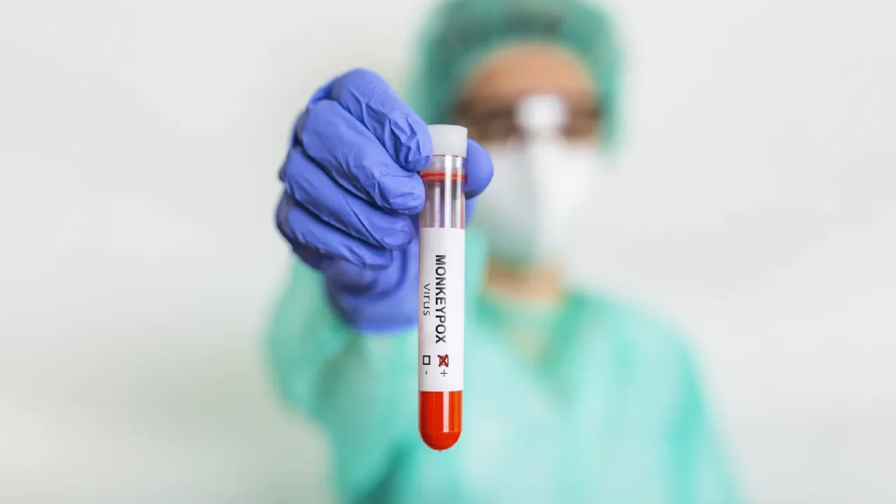 Viruela Símica: ¿En qué consiste el virus que tiene acorralado a África ...