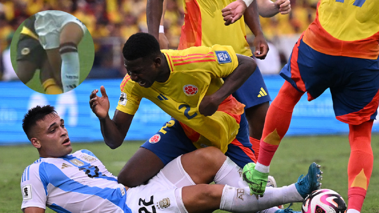 Figura de la Selección Colombia sufrió compleja lesión: "No pinta nada ...