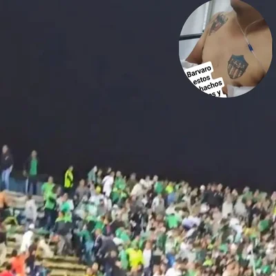 Hincha de Junior canta desde el hospital tras resultar herido en el ...