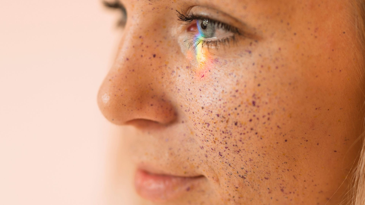 Manchas y pecas en el rostro: expertos explican por qué salen y cuáles ...